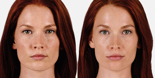 Before & After